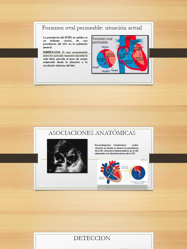 Foramen Oval Permeable | PDF