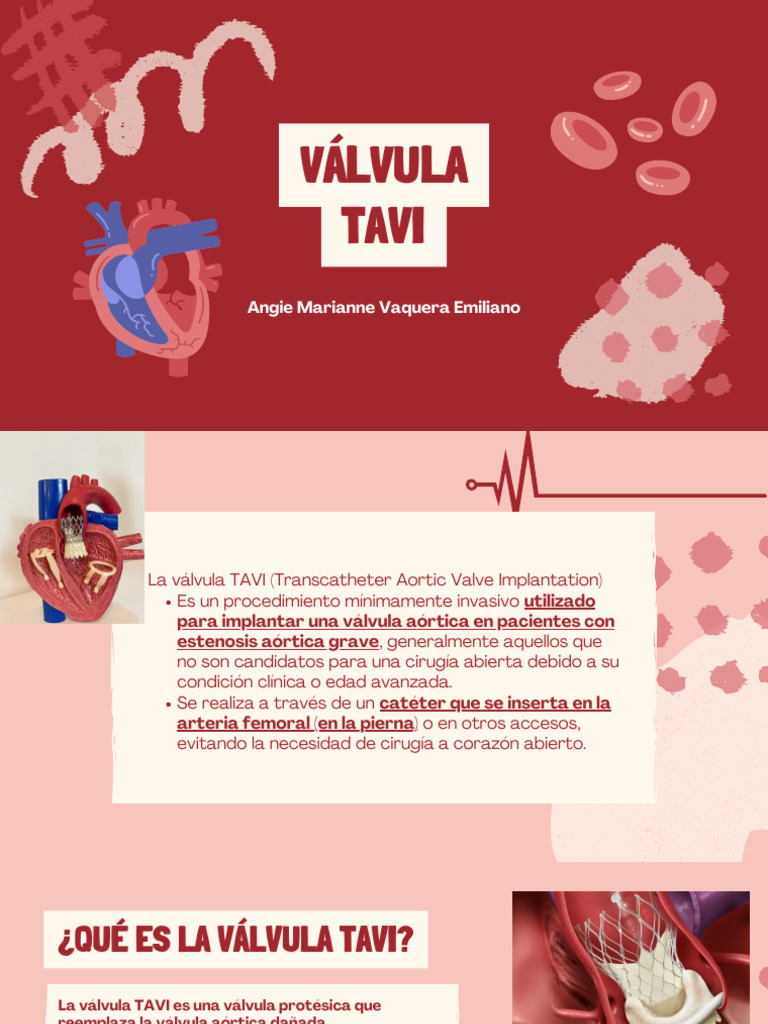 ¿Qué es la válvula TAVI? | PDF | Insuficiencia cardíaca | Marcapasos ...