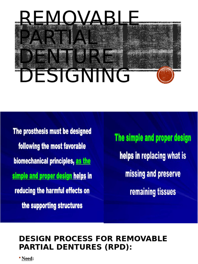 Designing Removable Partial Dentures | PDF