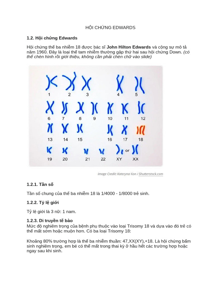 H I CH NG Edwards | PDF