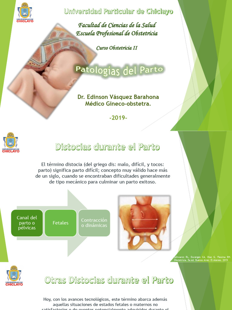 Distocias Del Trabajo de Parto | PDF | Parto | Salud maternal