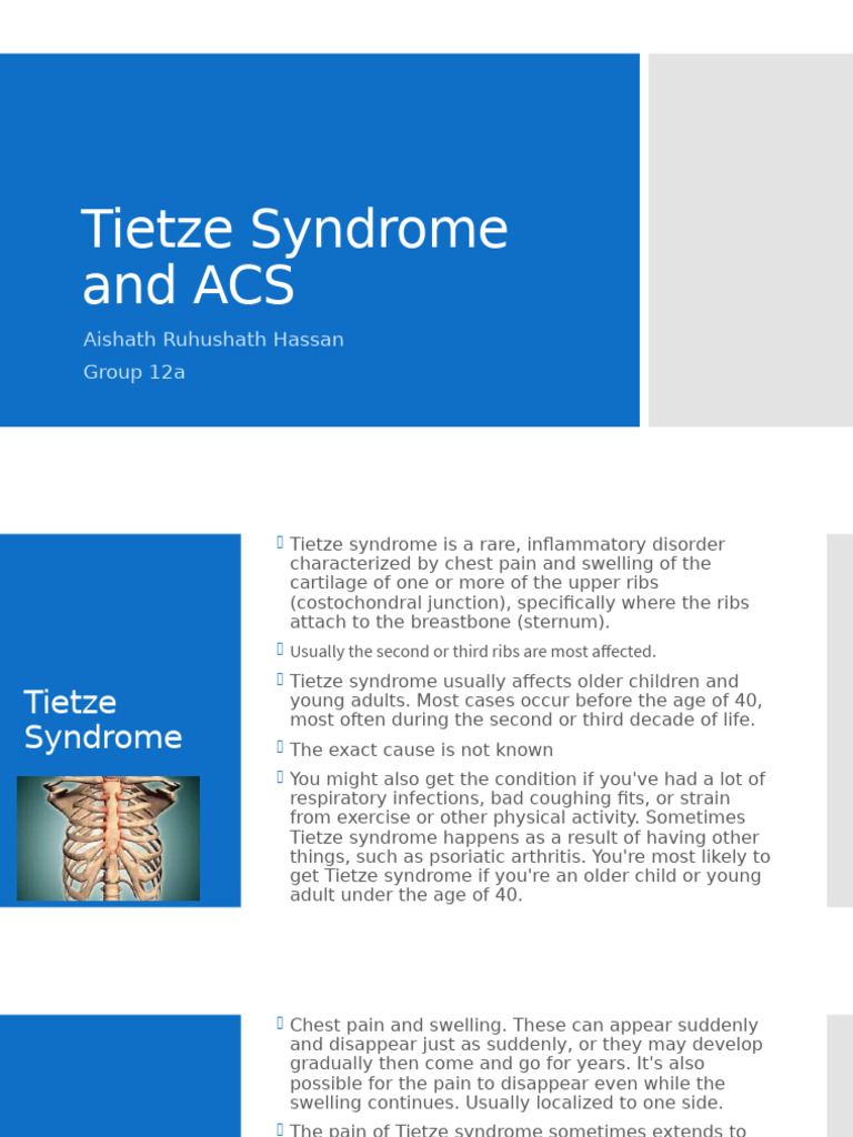 ACS and teitze syndrome | PDF | Myocardial Infarction | Diseases And ...