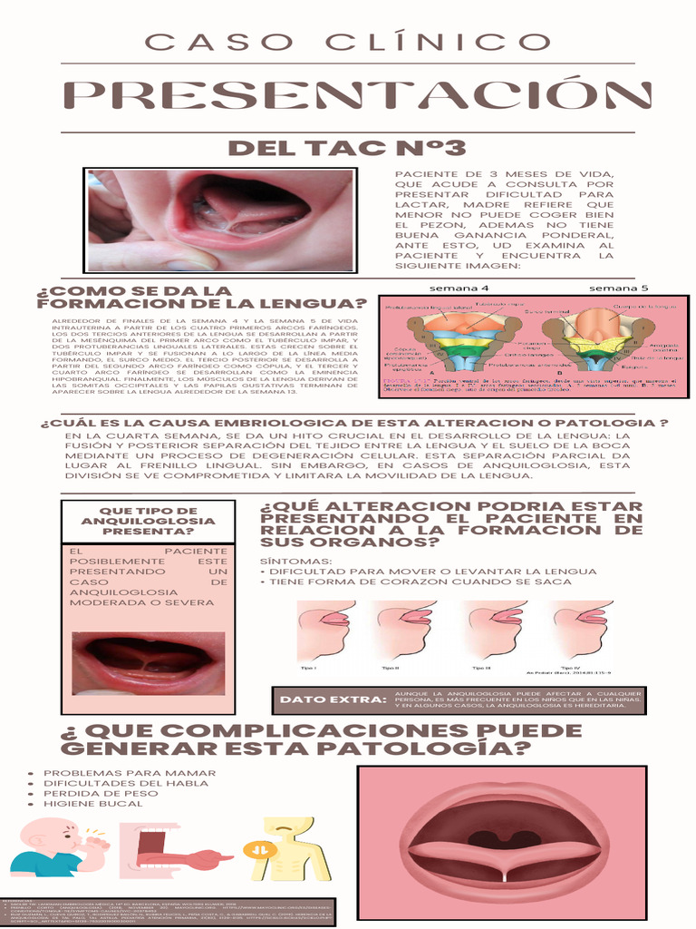 Infografía 33333 | PDF | Lengua | Especialidades Medicas