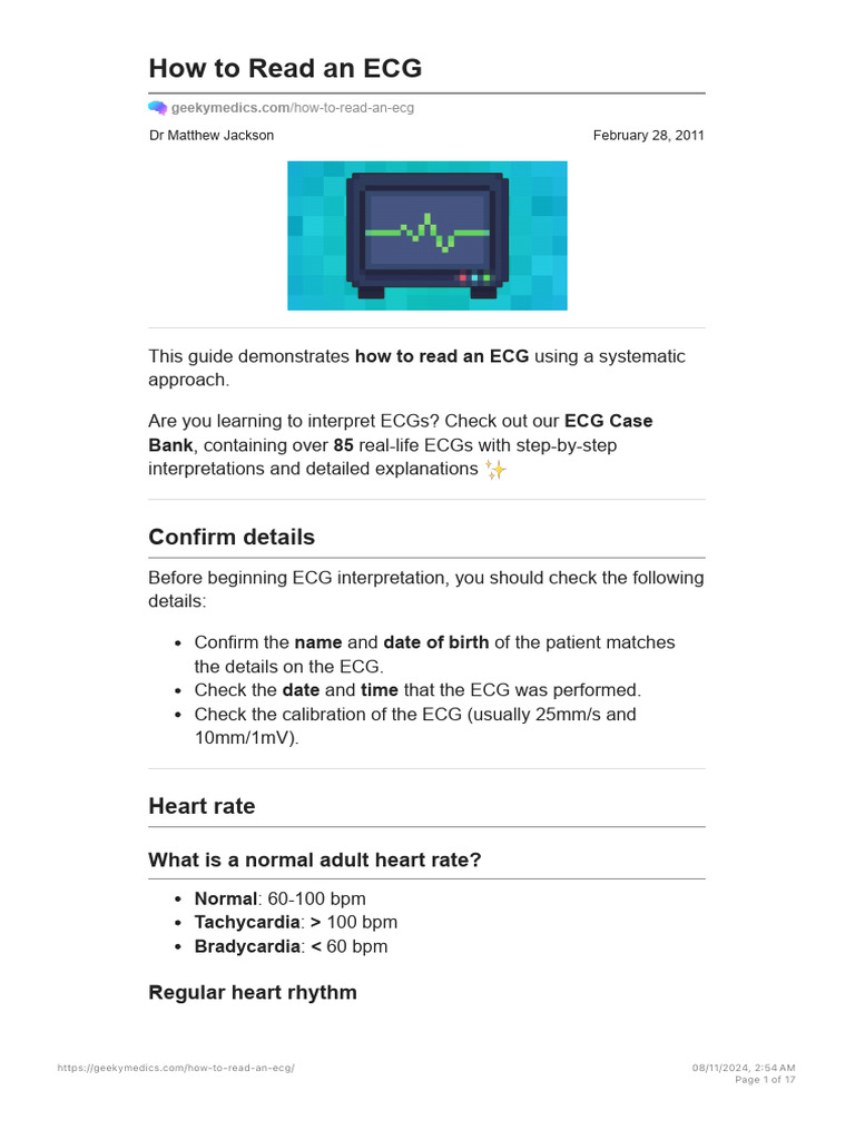 How To Read An Ecg Ecg Interpretation Ekg Geeky Medics How To Read An