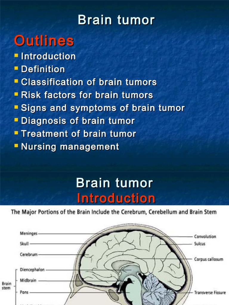 Brain Tumor PDF | PDF