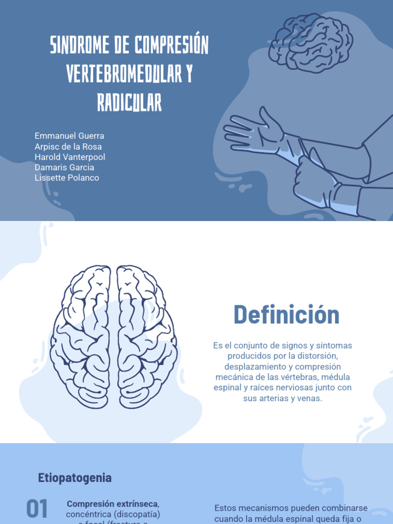 Sindrome de compresion Medular | PDF | Médula espinal | Vena