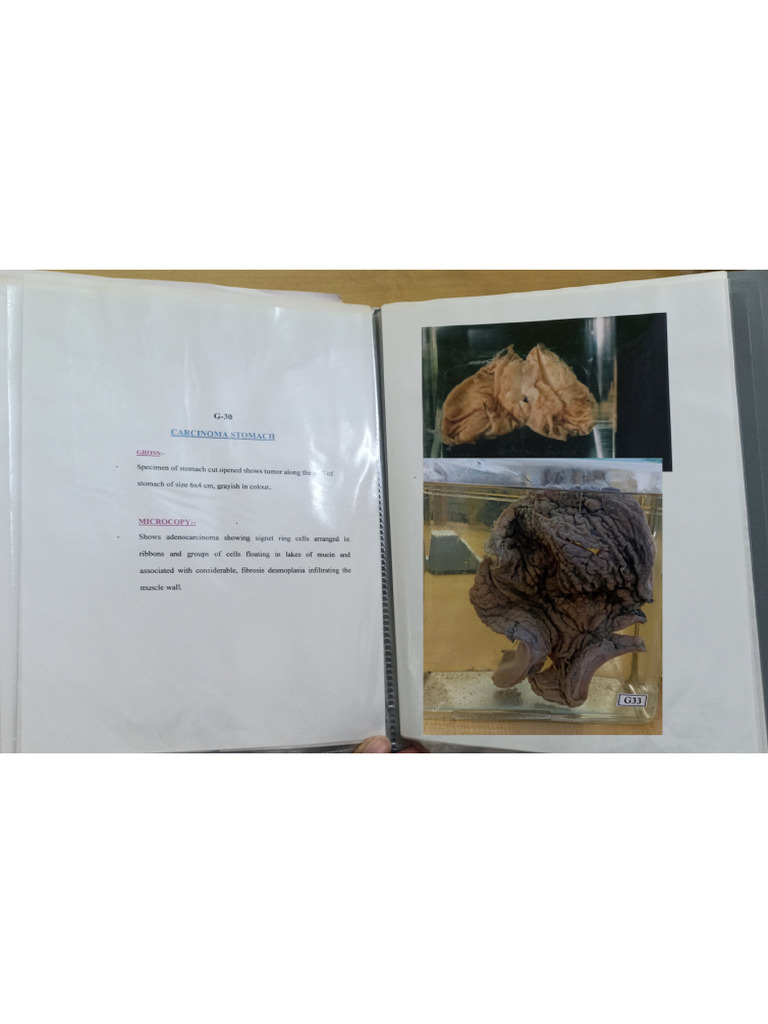 Specimen Patho | PDF
