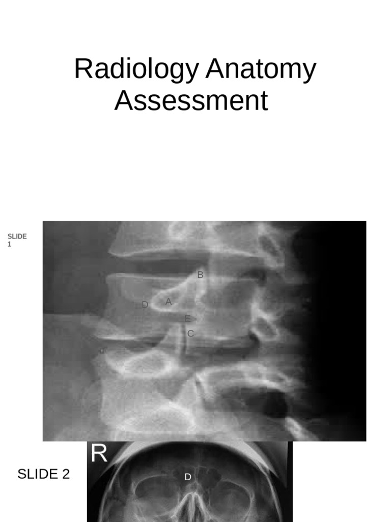 Radiology Anatomy Assessment | PDF