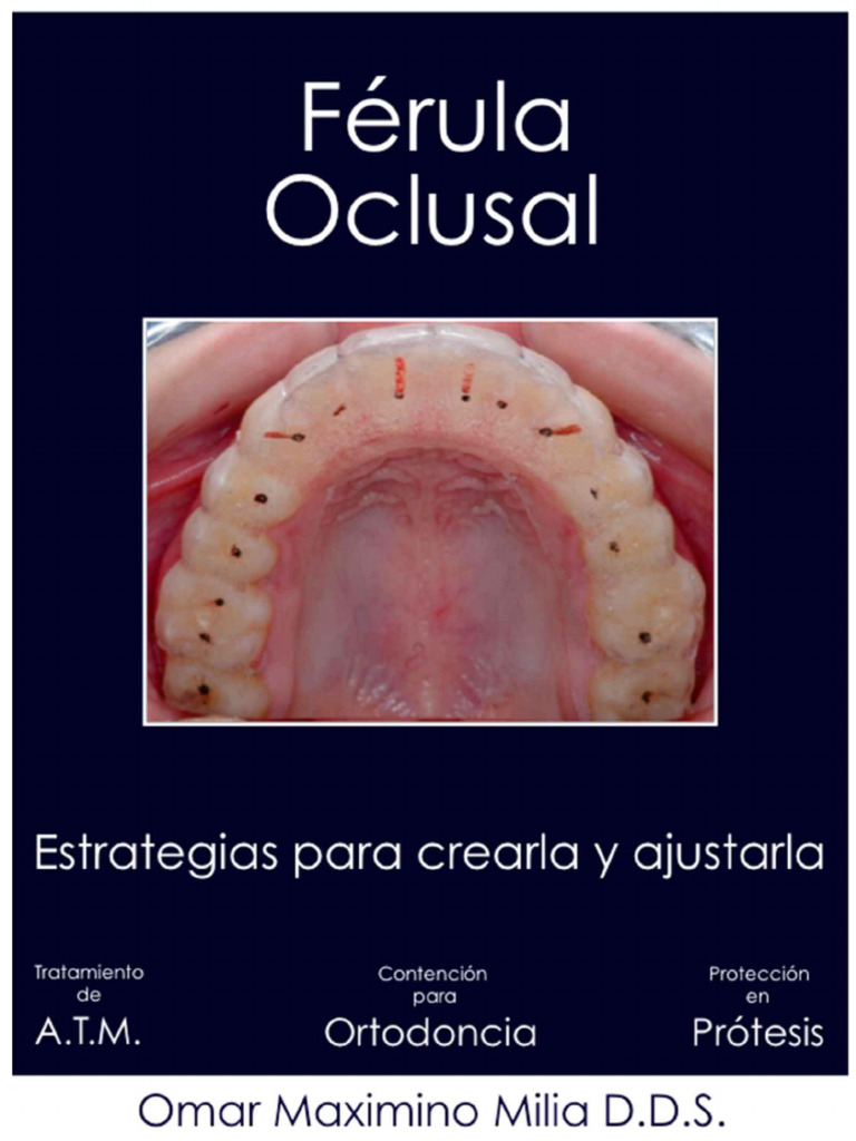 Férula Oclusal: Guía de Confección y Ajuste | PDF