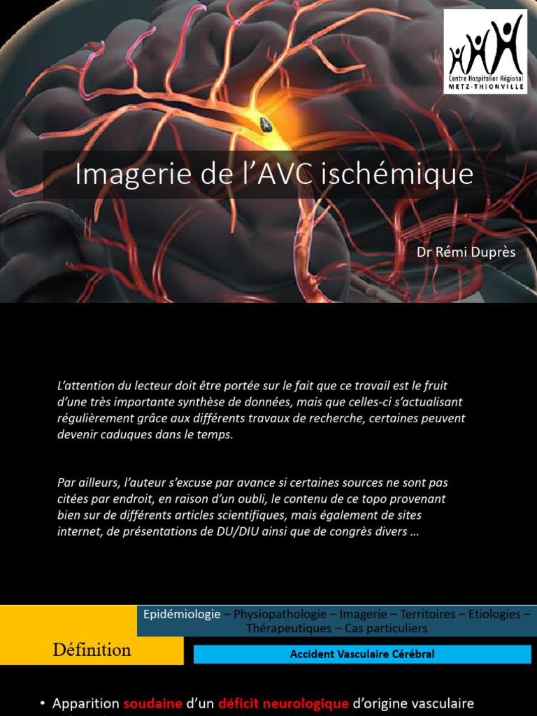 Imagerie de l'AVC Ischémique | PDF | Accident vasculaire cérébral ...