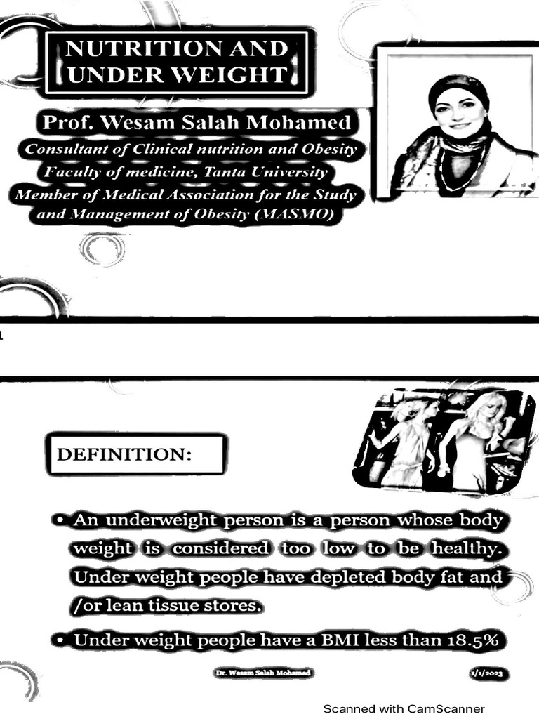 6 Dr. Wesam under weight المحاضرة الساد | PDF