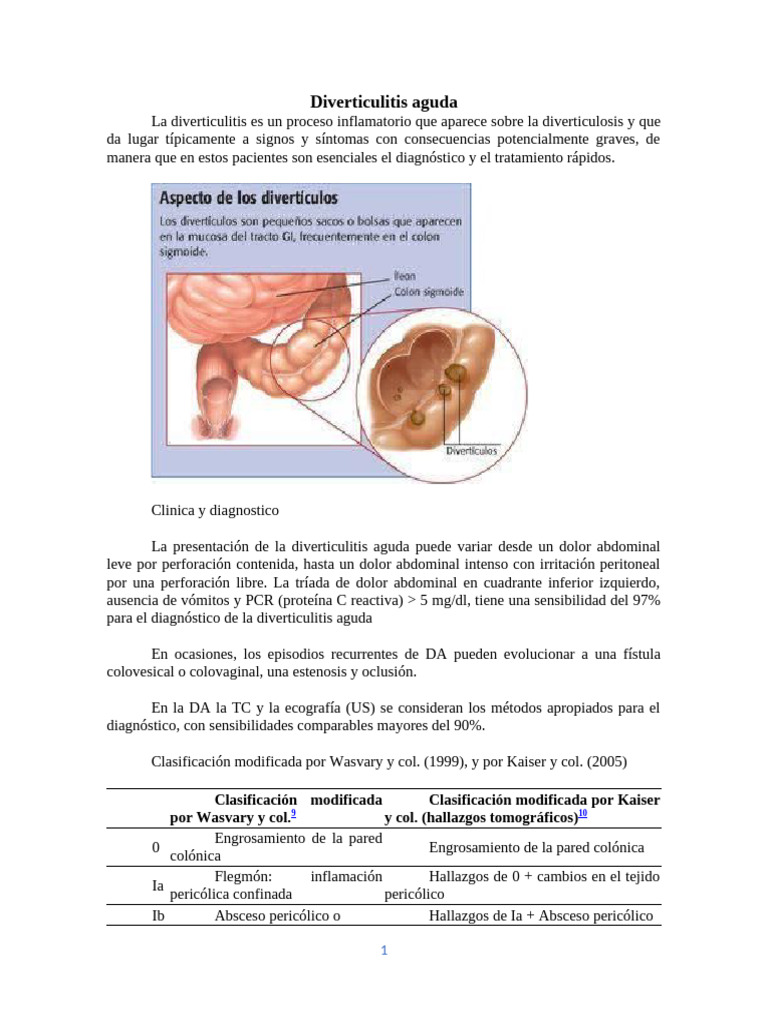 Diverticulitis Aguda | PDF | Medicina CLINICA | Especialidades Medicas