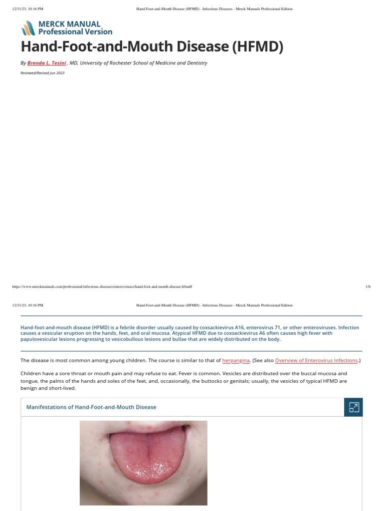 Hand-Foot-And-Mouth Disease (HFMD) - Infectious Diseases - Merck Manuals Professional Edition ...