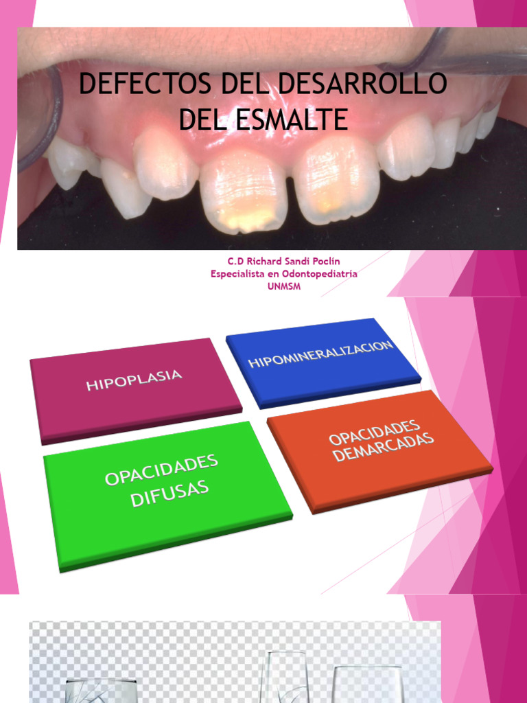 Defectos Del Desarrollo Del Esmalte | PDF | Ramas de Odontología ...
