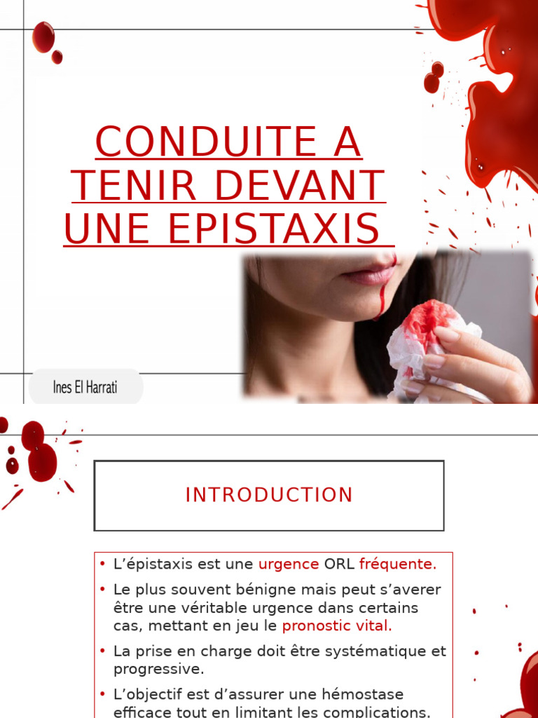 Prise en charge de l'épistaxis | PDF | Spécialités médicales | Sang