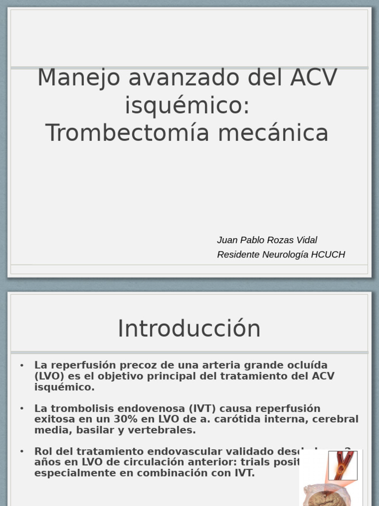 Acv Isquemico Agudo Trombectomia 2 | PDF | Carrera | Especialidades Medicas