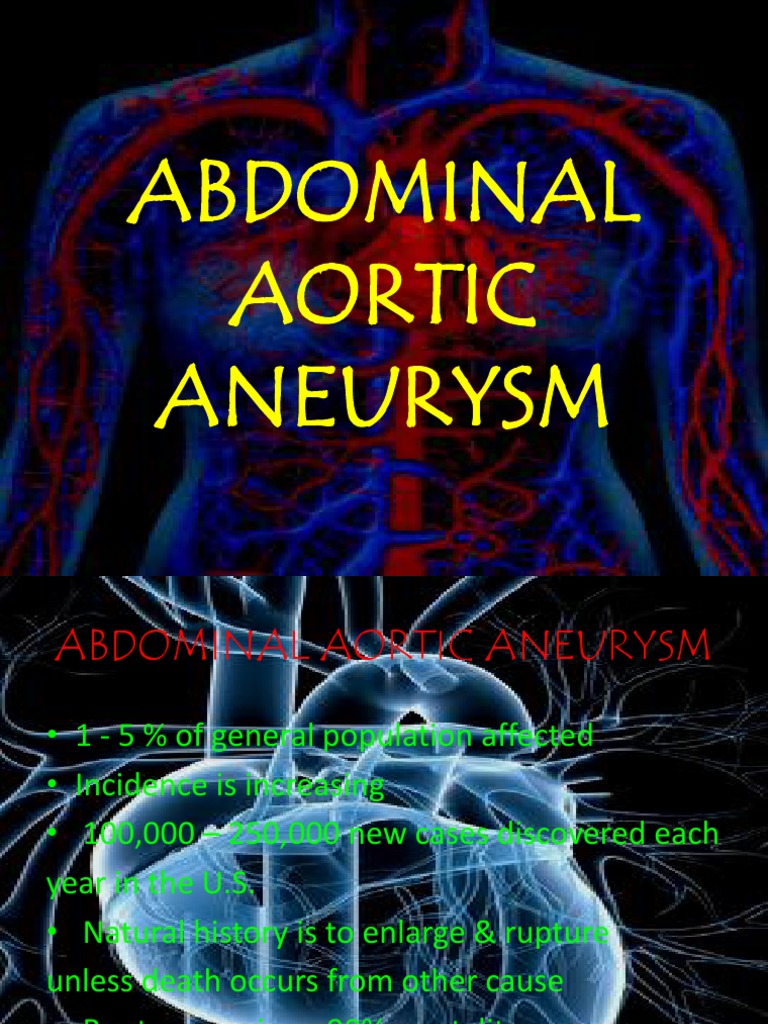 Abdominal Aortic Aneurysm | Aorta | Angiology