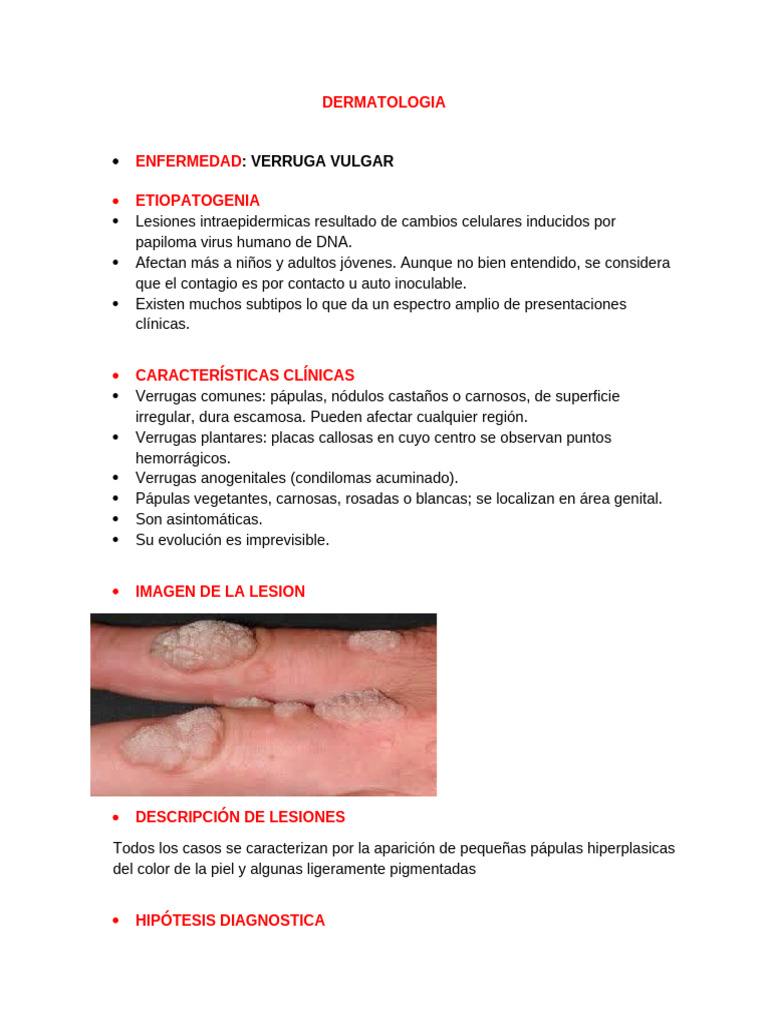 Verruga Vulgar: Diagnóstico y Tratamiento | PDF