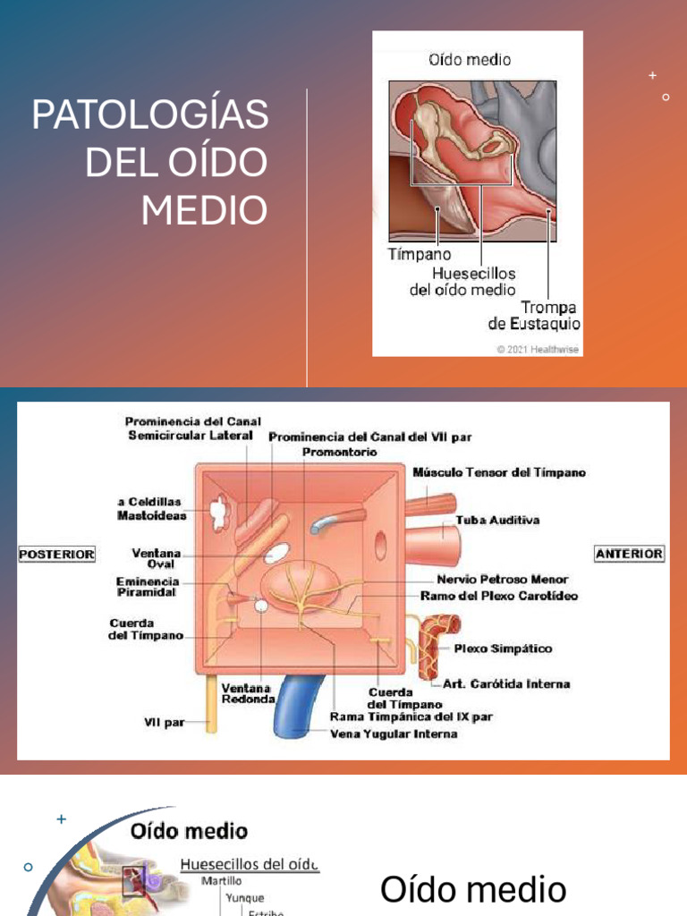 Timpanoesclerosis y Miringoesclerosis | PDF | Oído | Neoplasias