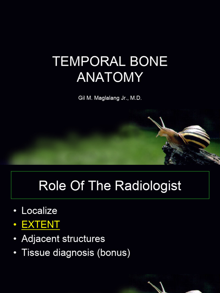 Temporal Bone Anatomy Overview | PDF | Ear | Human Head And Neck