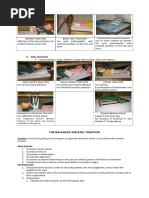 Balance Skeletal Traction | PDF | Clinical Medicine
