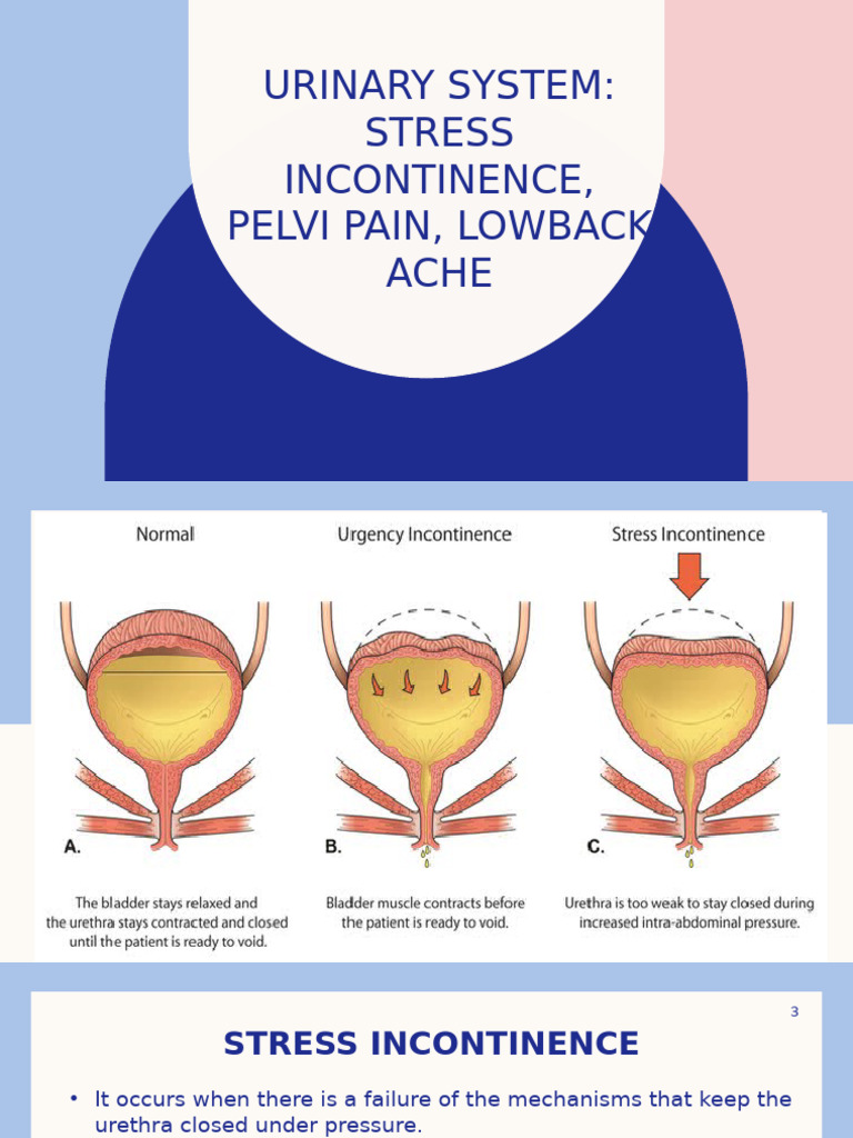 Obg - Stress Incontinnce | PDF | Urinary Incontinence | Back Pain