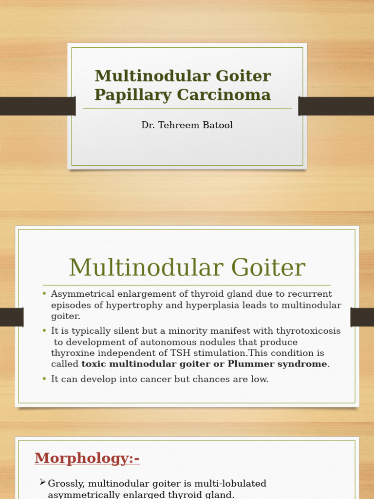 Multinodular Goiter, Papillary Carcinoma | PDF