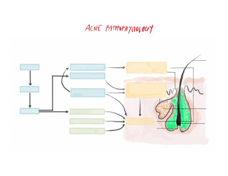 Acne Pathophysiology | PDF