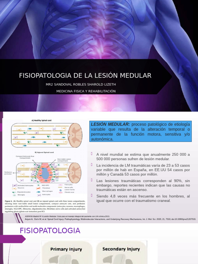 Fisiopatologia - Lesion Medular | PDF | Lesión de la médula espinal | Traumatologia
