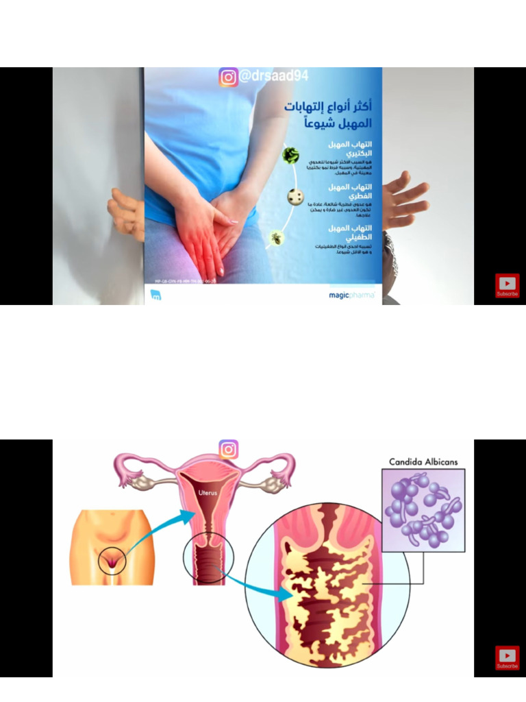 Médicament Gynéco | PDF