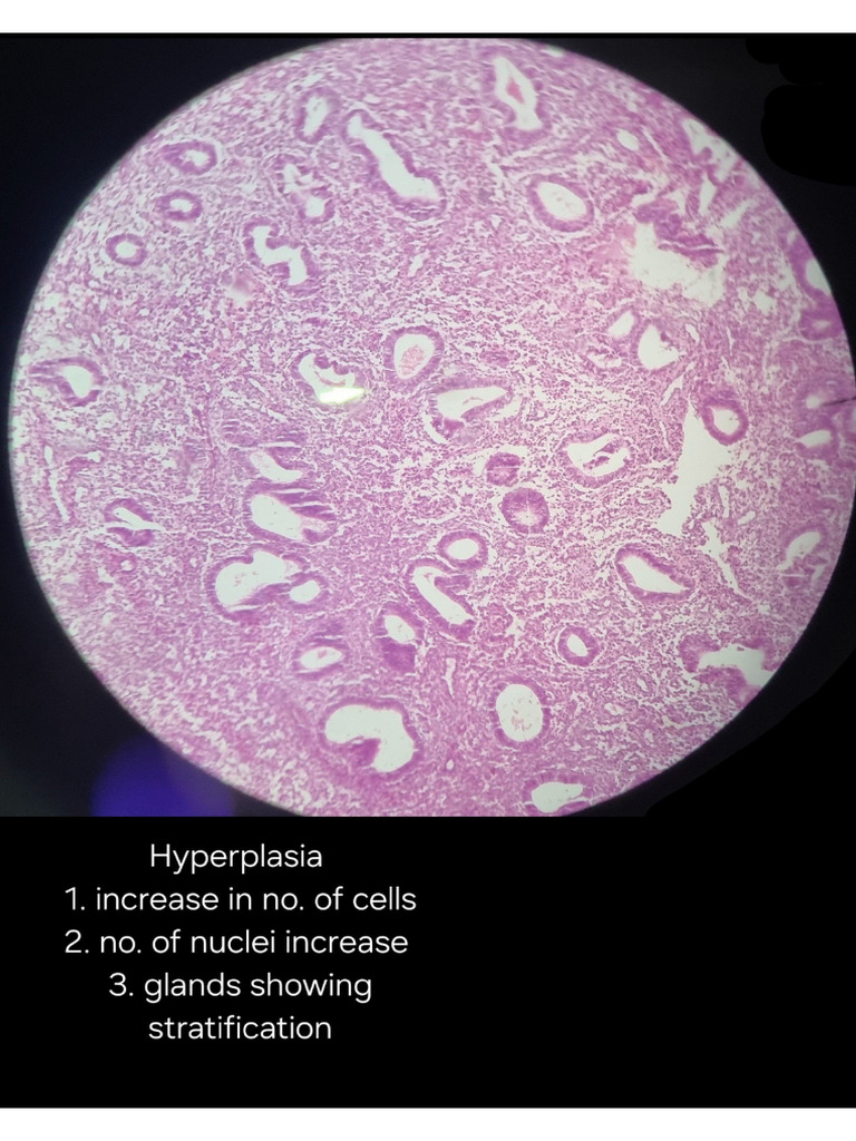 Histopathology Slides | PDF