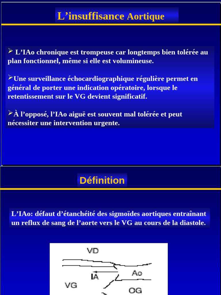 Insuffisance Aortique : Diagnostic et Traitement | PDF | Système cardio ...