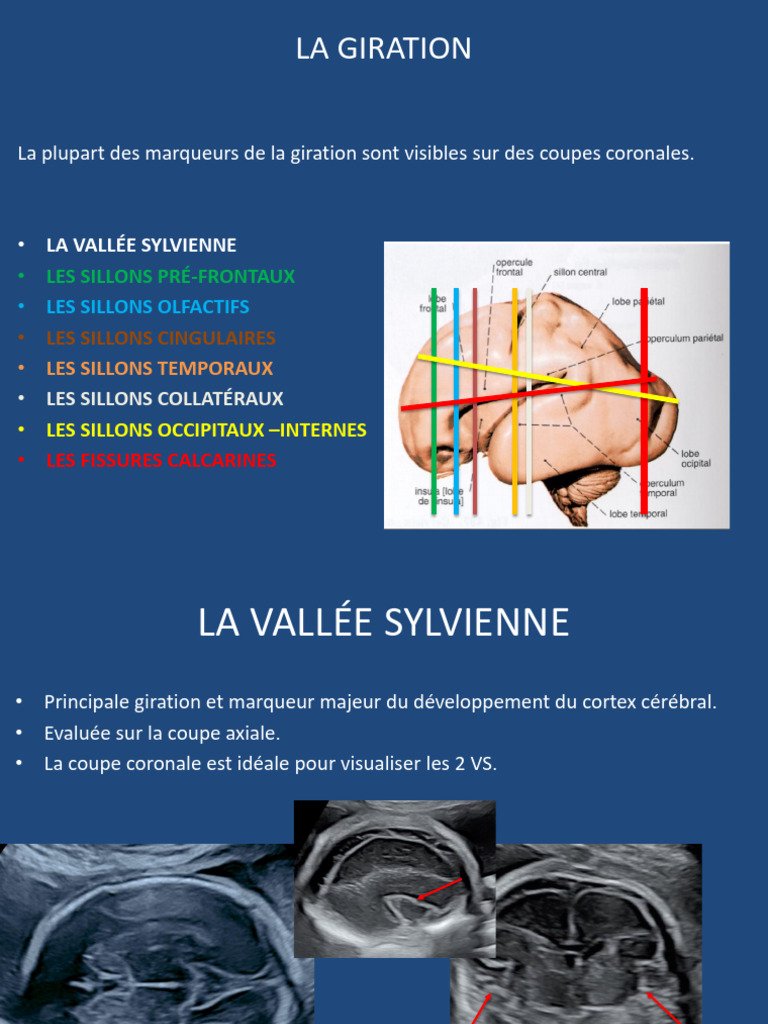 Cerveau Foetal Normal 2é Partie - 2 | PDF | Cortex insulaire ...