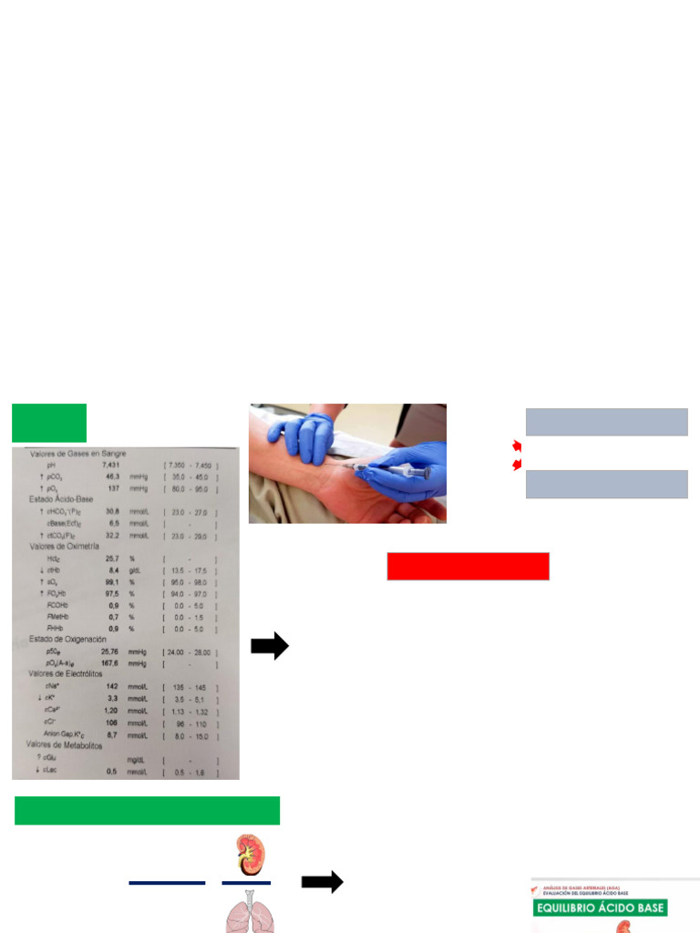 Semana 01. Análisis de Gases Arteriales (Aga) | PDF | Emergencias ...
