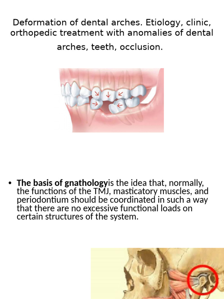 Deformation of Dental Arches. | PDF | Orthodontics | Tooth
