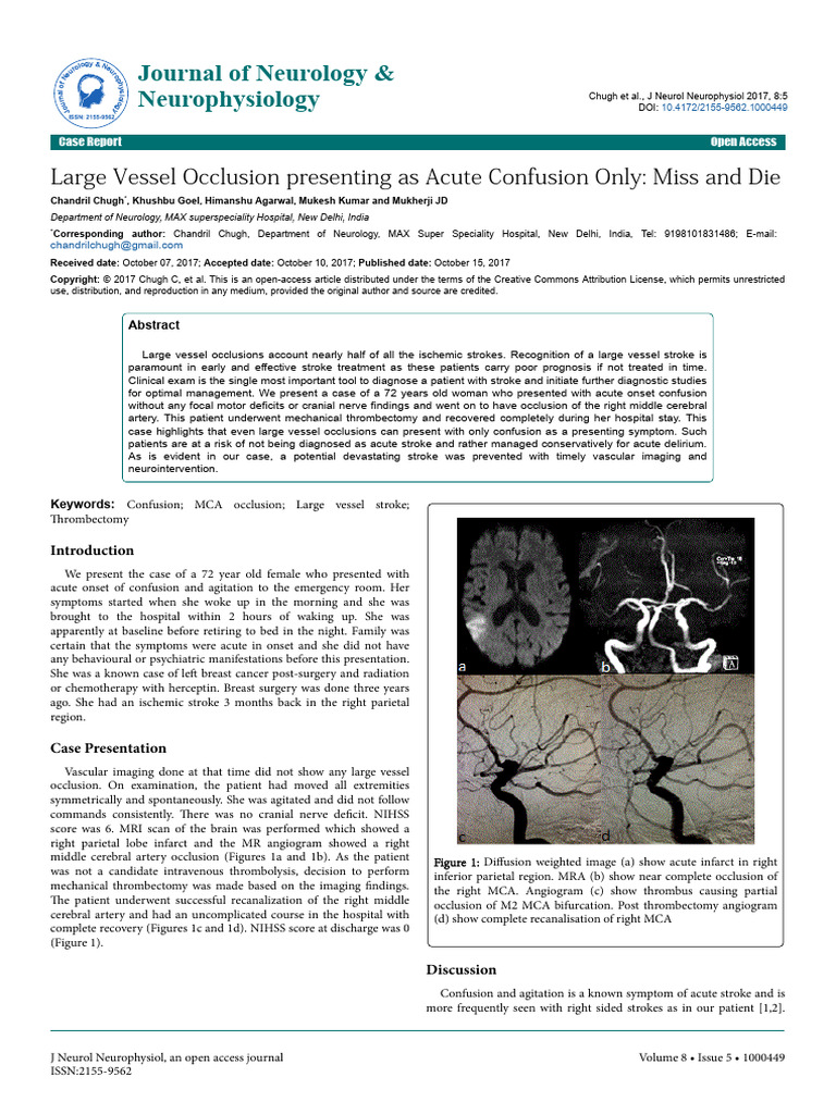 Open Accesslarge Vessel Occlusion Presenting As Acute Confusion Only ...