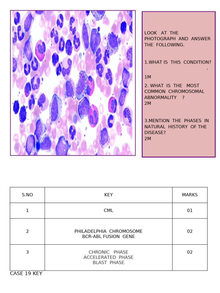 19 CML | PDF
