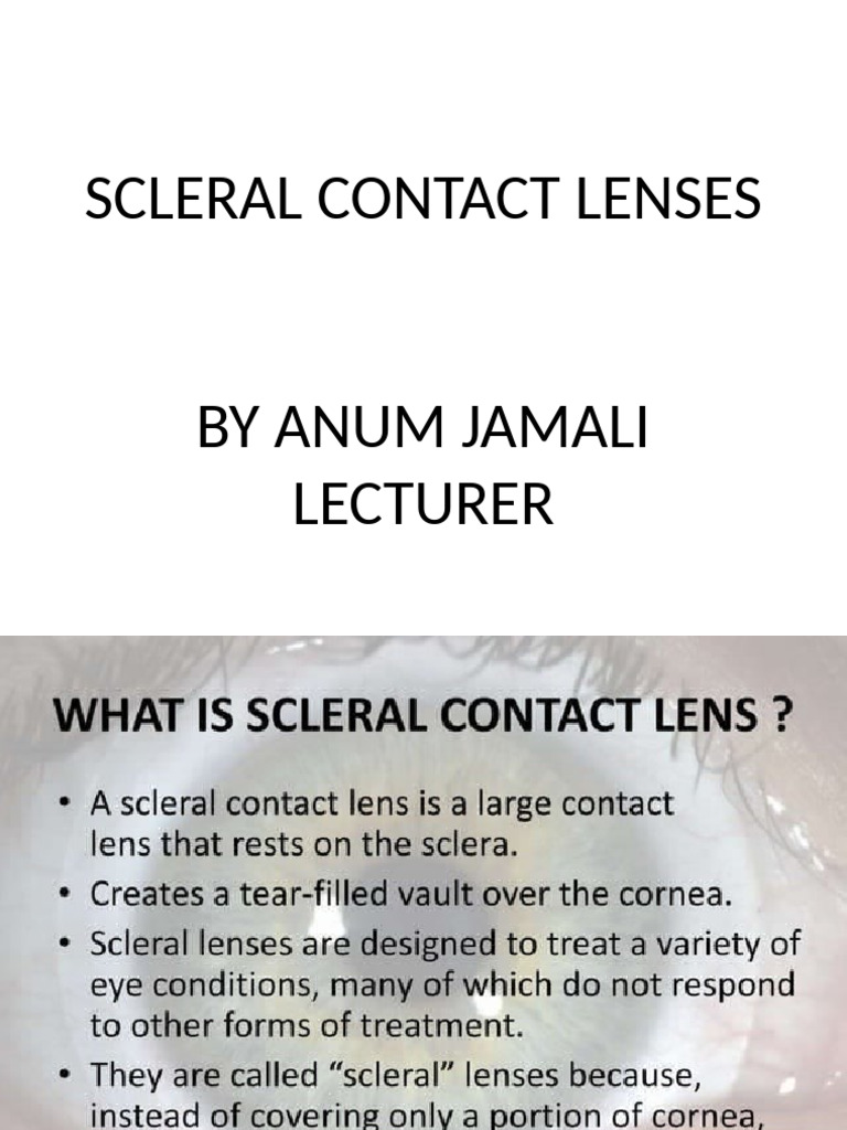 Introduction To Scleral Lenses | PDF