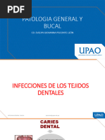 Etapas y Grados de Caries PDF | PDF | Diente | Odontología