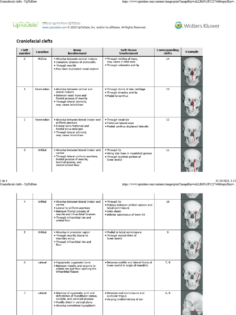 Craniofacial Clefts - UpToDate | PDF