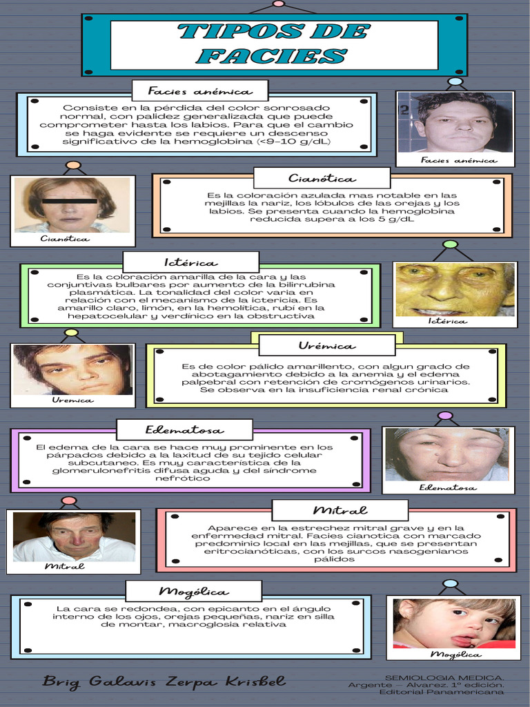 Infografia Informativa Facies | PDF