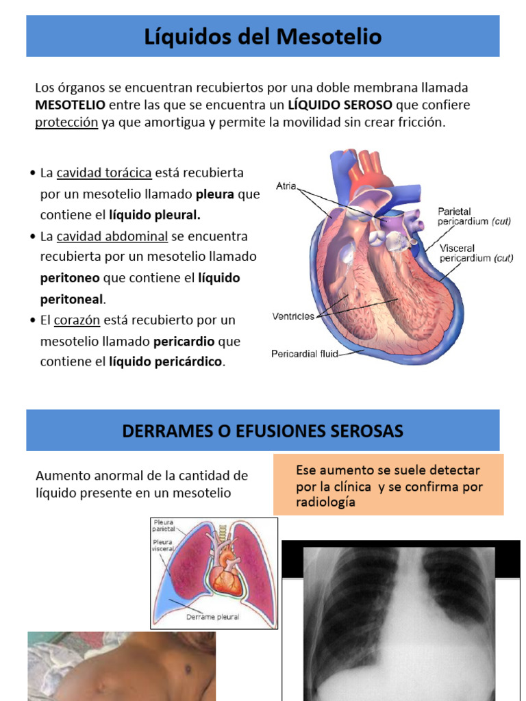 9.3. Líquidos Del Mesotelio | PDF | Medicina CLINICA | Especialidades ...