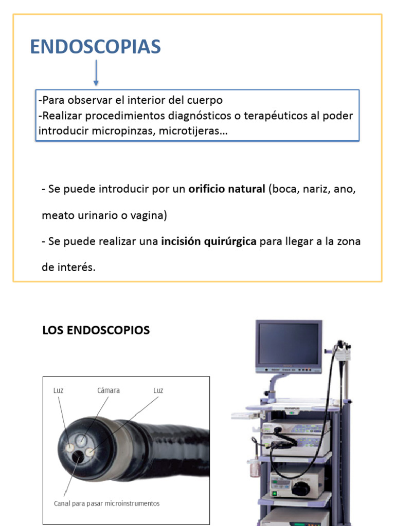 9.6. Endoscopia | PDF | Biopsia | Endoscopia