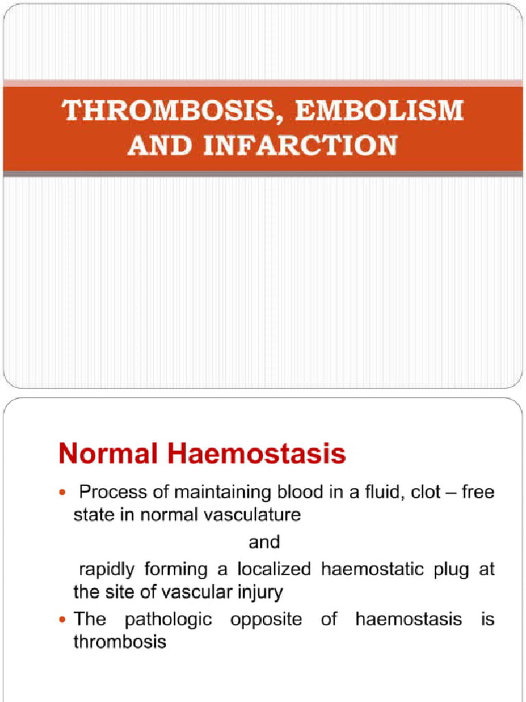 Thrombosis Embolism and Infarction 86299682 | PDF