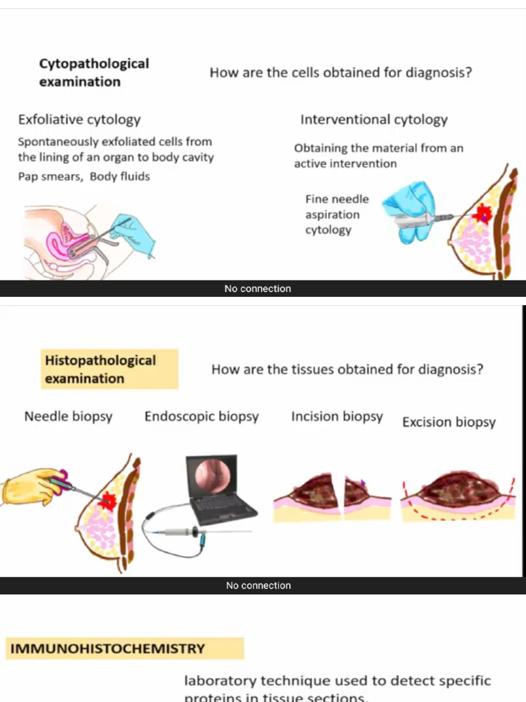 Lab Diagnosis Cancer | PDF