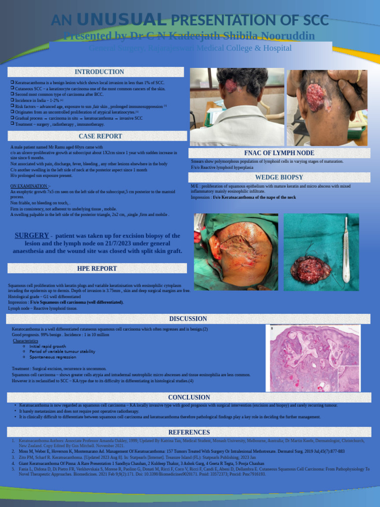 Shibila Final Poster SCC | PDF | Carcinoma | Medical Specialties