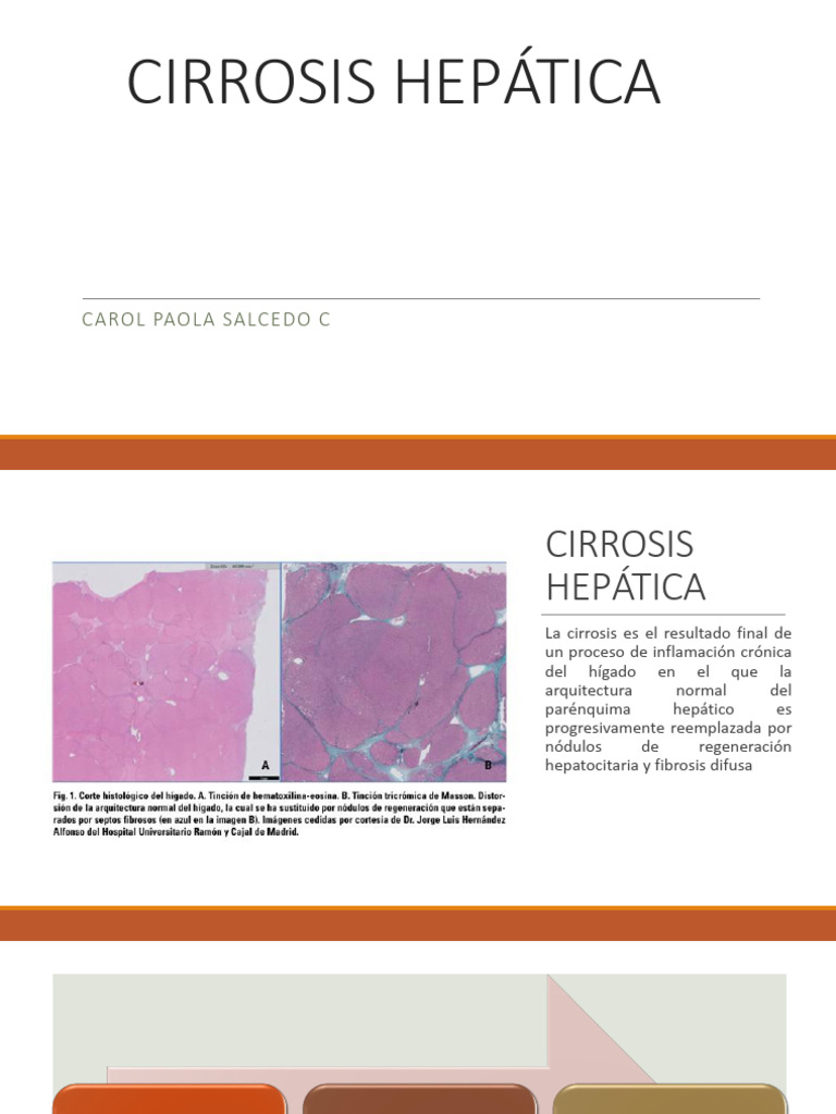 Cirrosis Hepatica | PDF | Cirrosis | Hepatitis