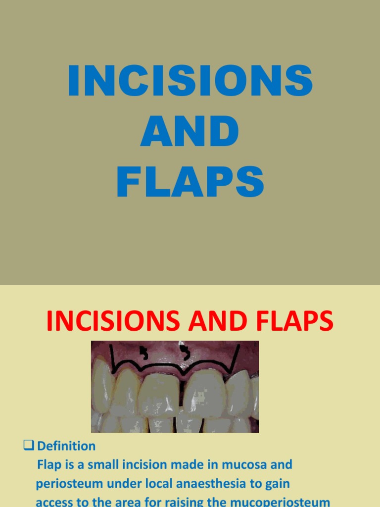 Incisions and Flaps | PDF | Dentistry | Human Head And Neck