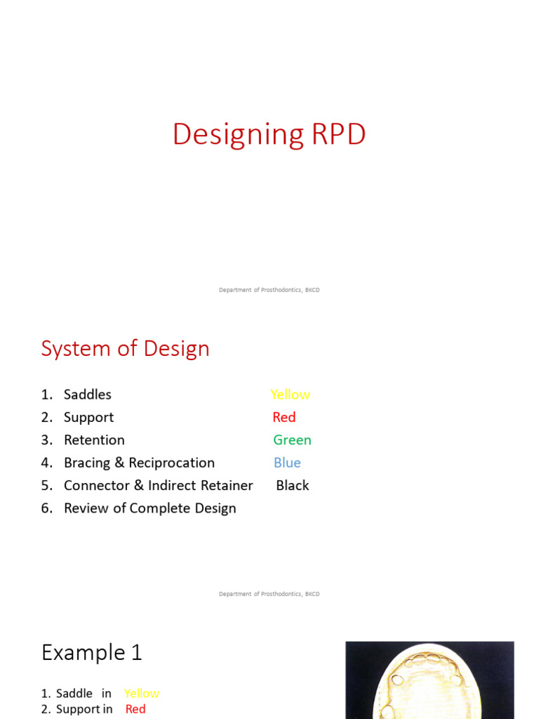 9.designing RPD | PDF