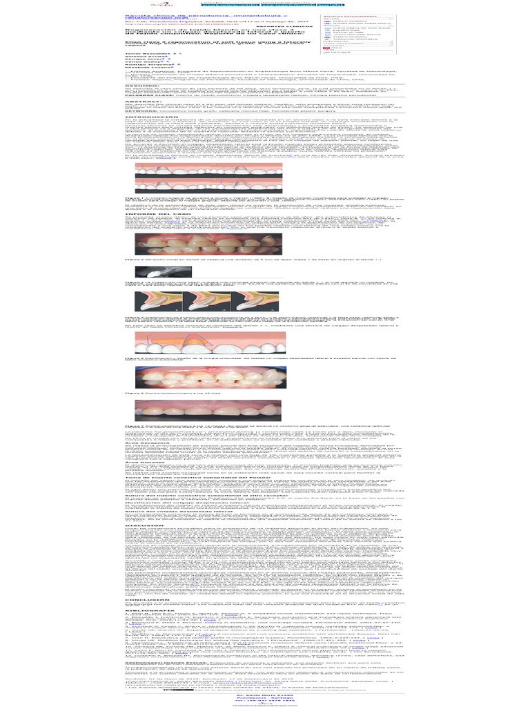 Regeneración de Tejido Blando en Una Clase 3 Mediante Un Colgajo Desplazado Lateral e Injerto de ...